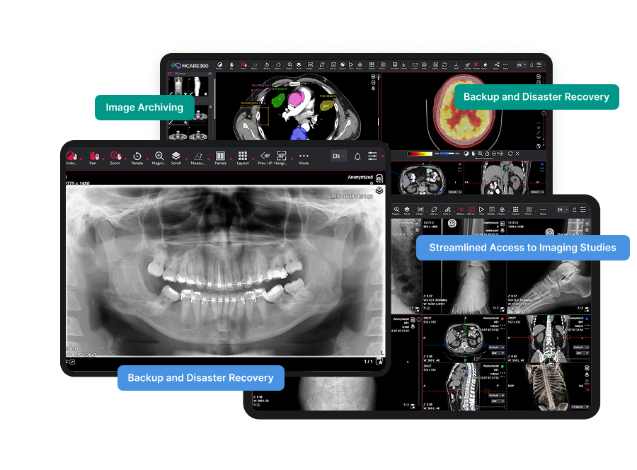 Teleradiology Solution - MCare360